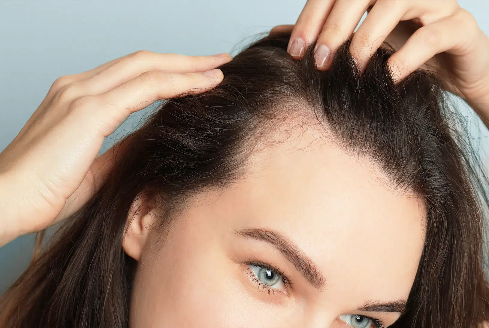 Traitement de la perte de cheveux à Québec – Alopécie et solutions